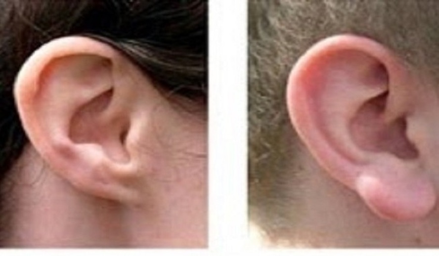 Εσύ το ήξερες;; Δες τι λένε τα αφτιά σου για την καταγωγή σου ...