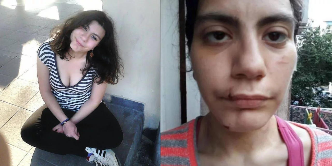 ΣΟΚ ΚΑΙ ΑΠΟΤΡΟΠΙΑΣΜΟΣ ΓΙΑ ΤΟ ΜΑΡΤΥΡΙΟ ΤΗΣ ΦΑΙΗΣ – ΤΗ ΣΑΠΙΖΑΝ ΣΤΟ ΞΥΛΟ ...