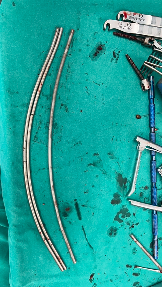 ΔΗΛΑΔΗ Ο ΑΣΘΕΝΗΣ ΛΙΓΟ ΠΡΙΝ ΤΟ …ΝΥΣΤΕΡΙ ΣΤΟ ΤΡΑΠΕΖΙ ΤΟΥ ΧΕΙΡΟΥΡΓΕΙΟΥ ...